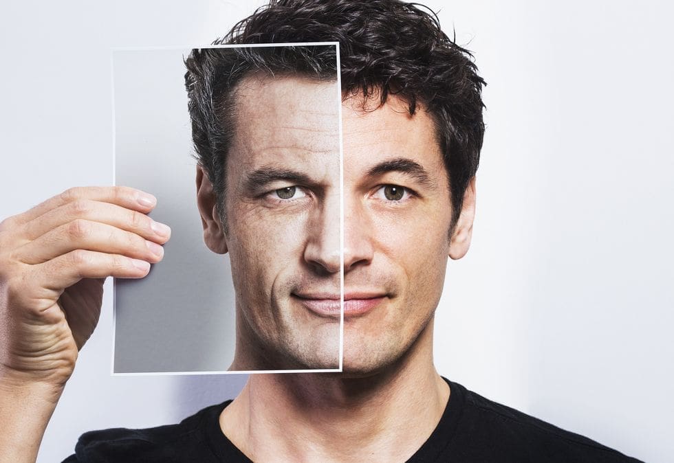 Melasma in Men: Understanding The Frustrating Skin Condition