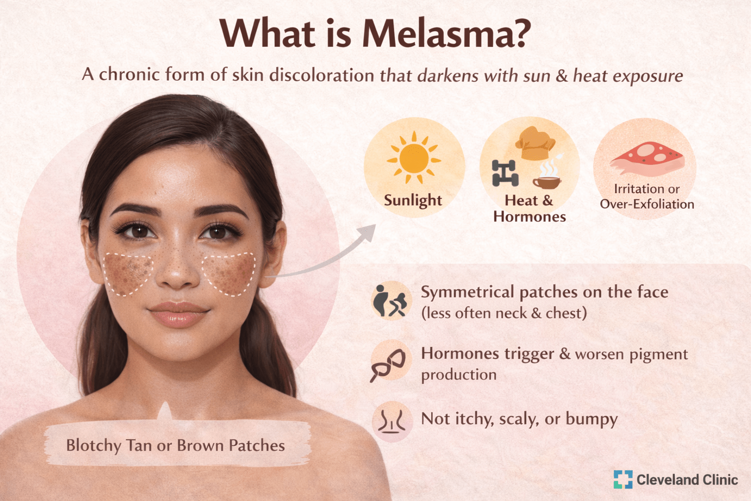 What Melasma Looks Like and Its Characteristics - Serene Skin Health